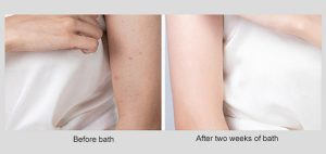 Intervention effect of hydrogen rich water on skin